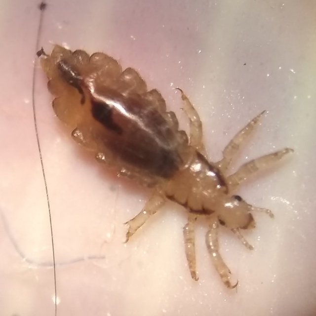 Human Louse LICE | Education